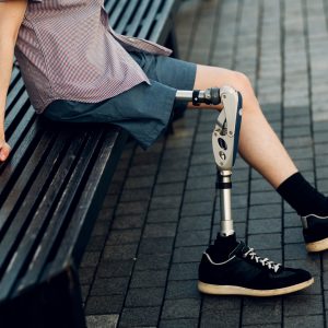 Ortomove – Expertos en prótesis y materiales ortopédicos